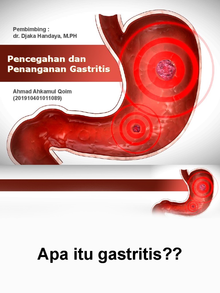 Pencegahan Dan Penanganan Gastritis | PDF