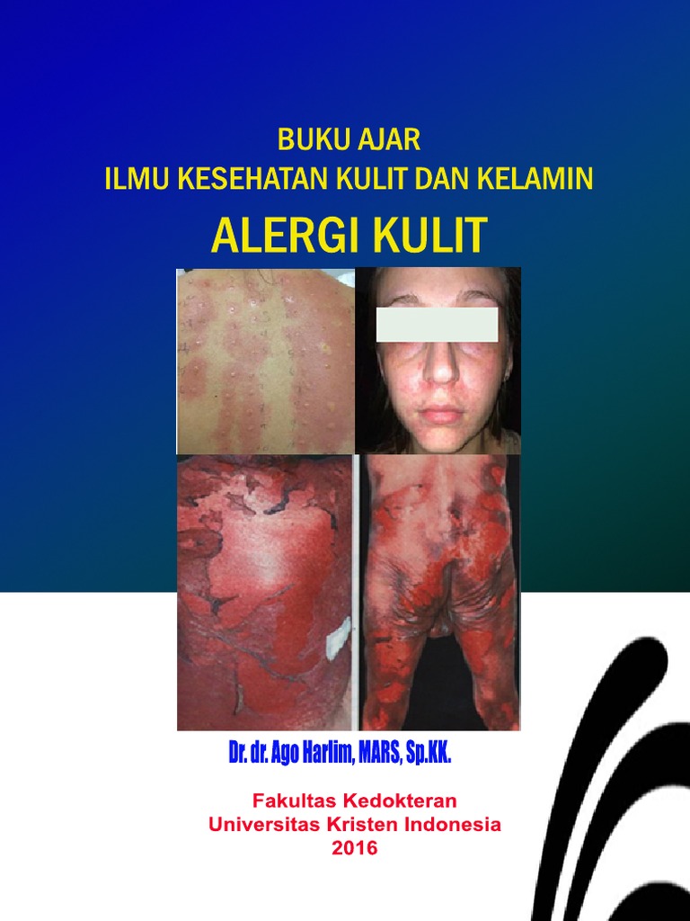Buku Penyakit Alergi | PDF