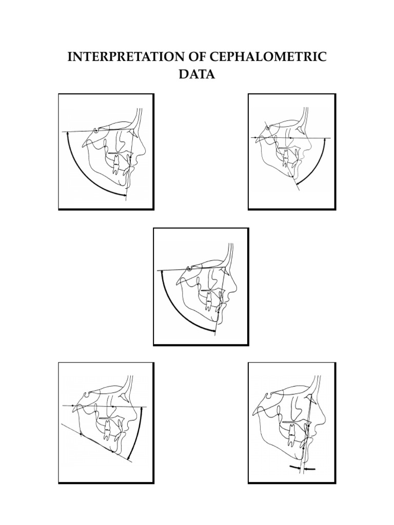 Interpretation of Cephalometric Data | PDF | Human Anatomy | Human Head ...
