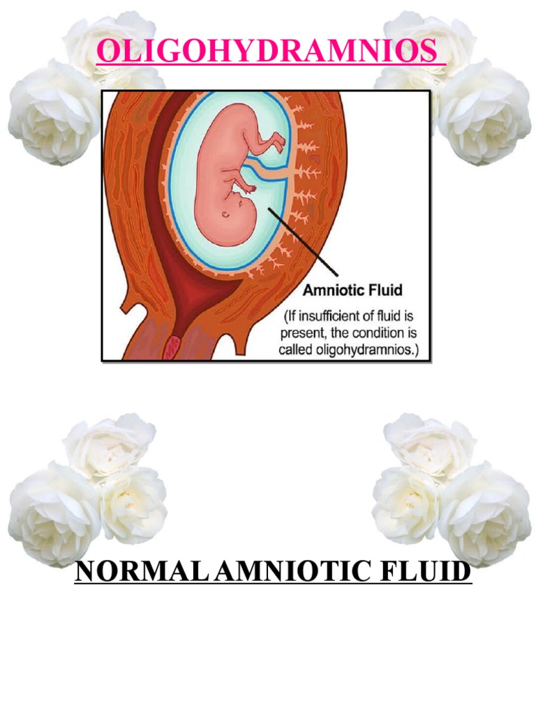 OLIGOHYDRAMNIOS | PDF | Fetus | Childbirth