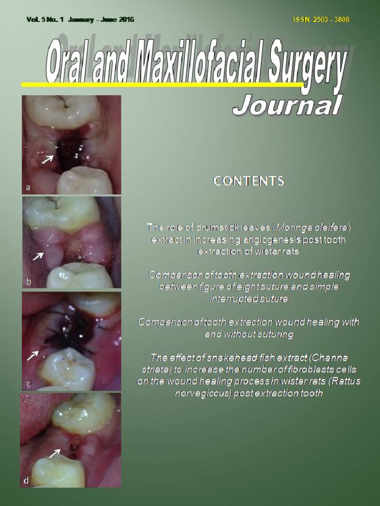 Oral and Maxillofacial Surgery Journal (E-Journal) Vol.5 No.1 Jan-Juni ...