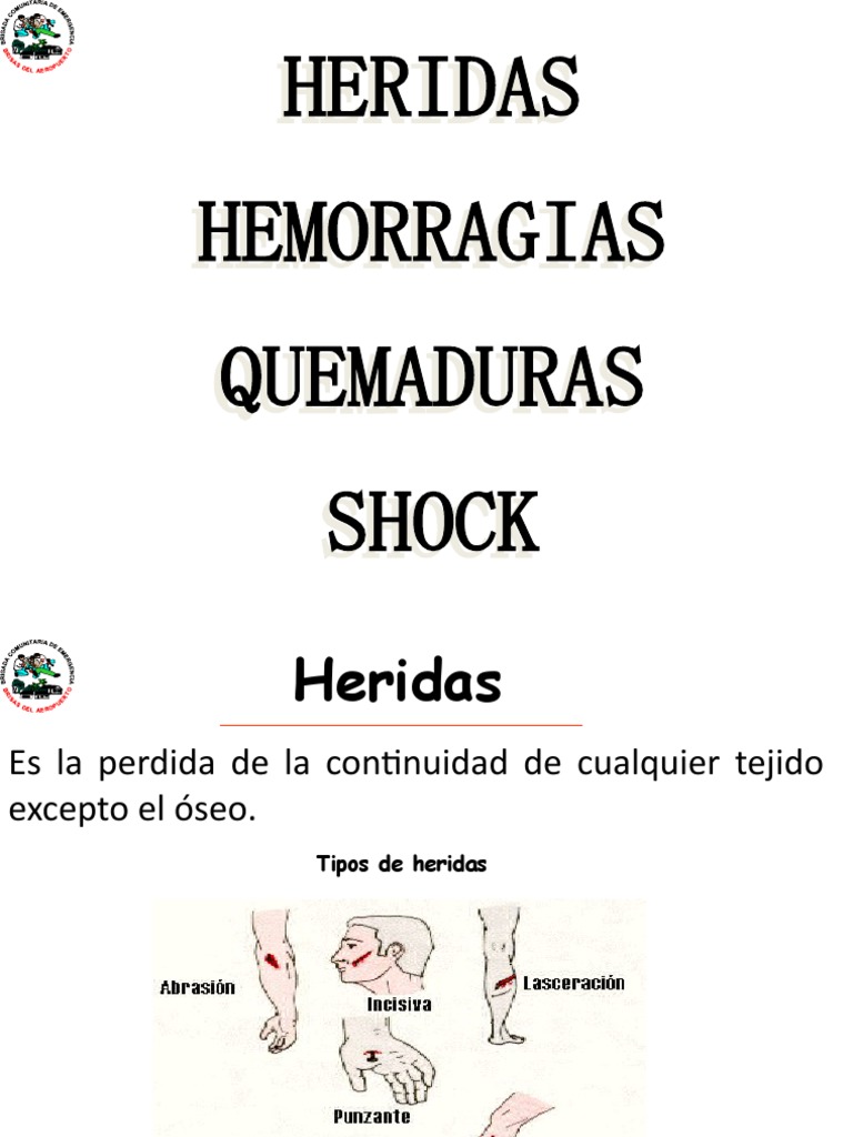 Presentación Clase 4 Heridas Hemorragias Quemaduras y Shock | PDF | Quemar | Herida