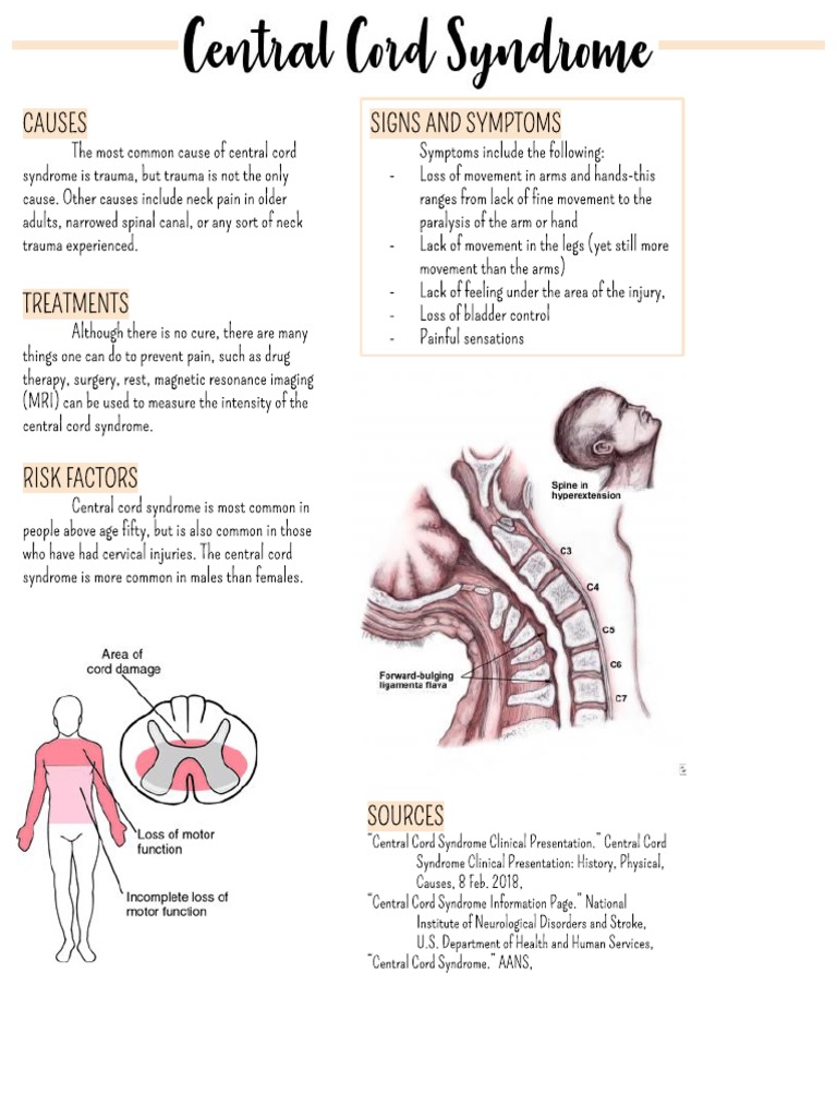 Central Cord Syndrome | PDF