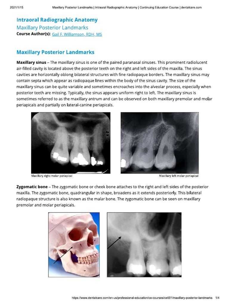 Maxillary Anatomical Landmarks 2 | PDF