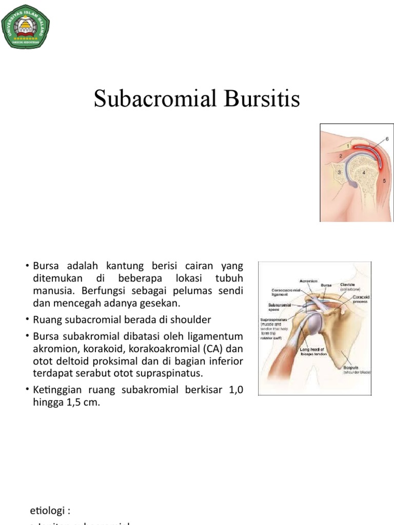 Bursitis Subakromial: Gejala dan Pengobatan | PDF
