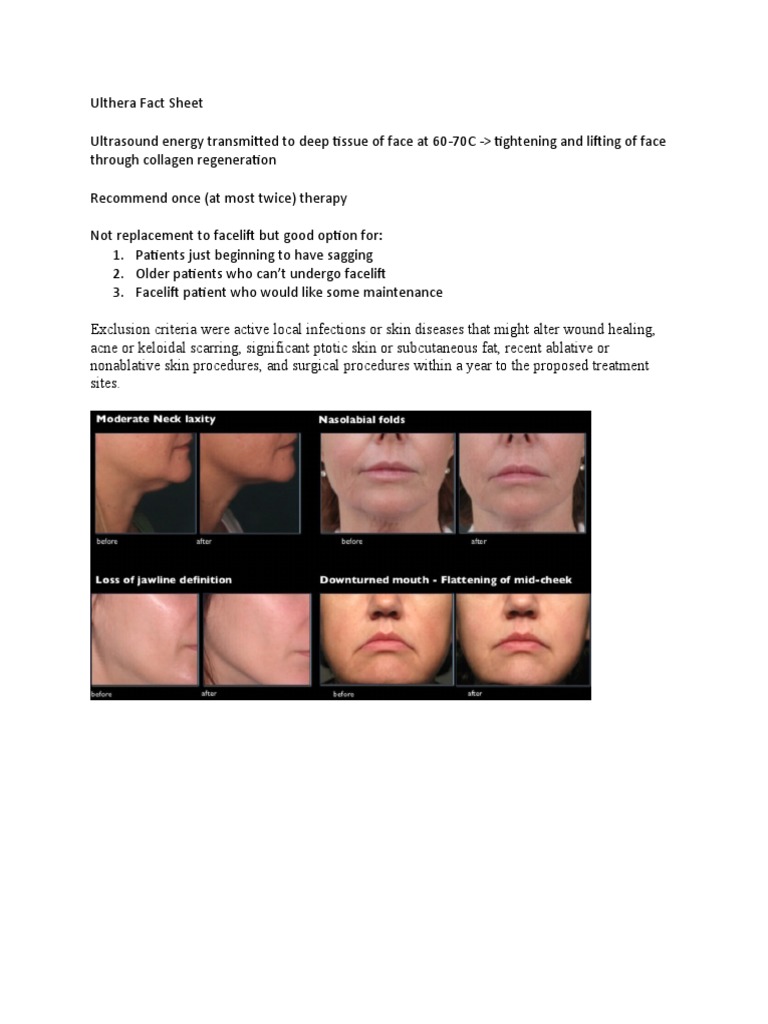 Ulthera Fact Sheet | PDF