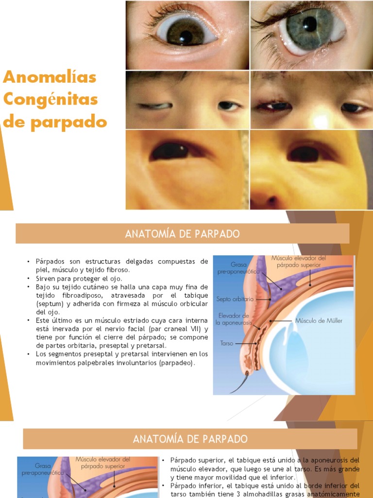 Anomalías Congénitas de Parpado | PDF | Oftalmología | Especialidades Medicas