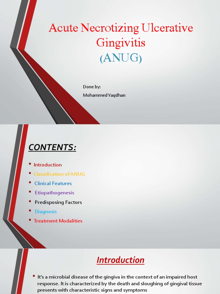 Acute Necrotizing Ulcerative Gingivitis: (ANUG) | PDF | Dentistry ...