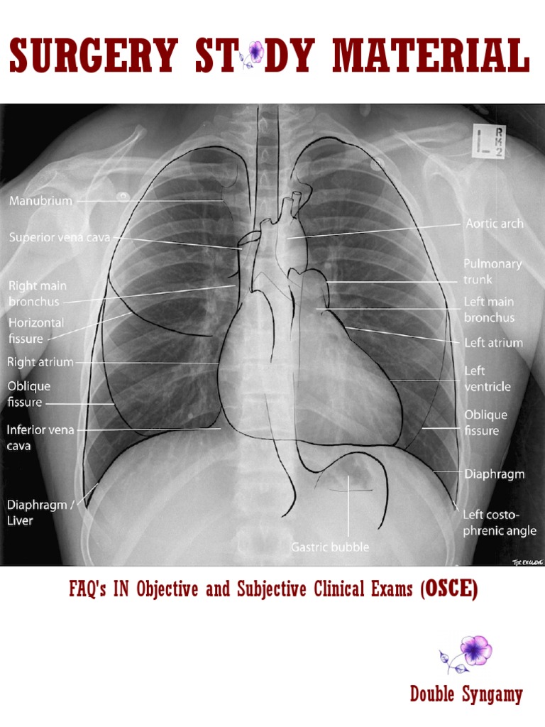Surgery OSCE Questions | PDF | Anatomy | Human Anatomy