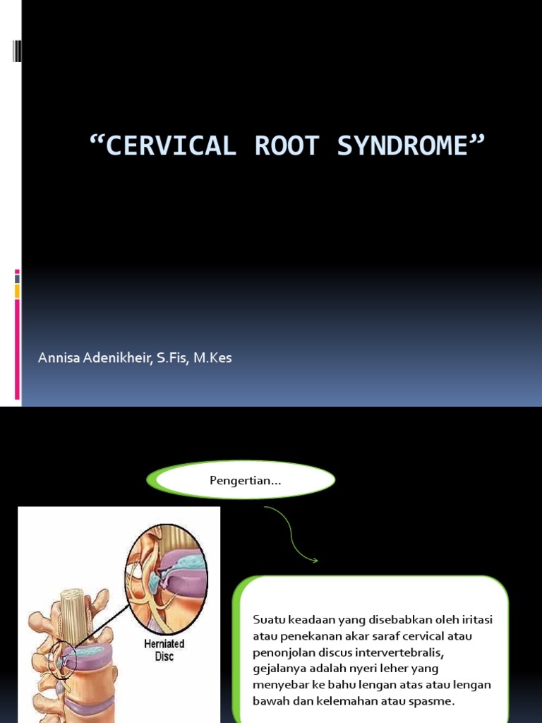 Cervical Root Syndrome | PDF