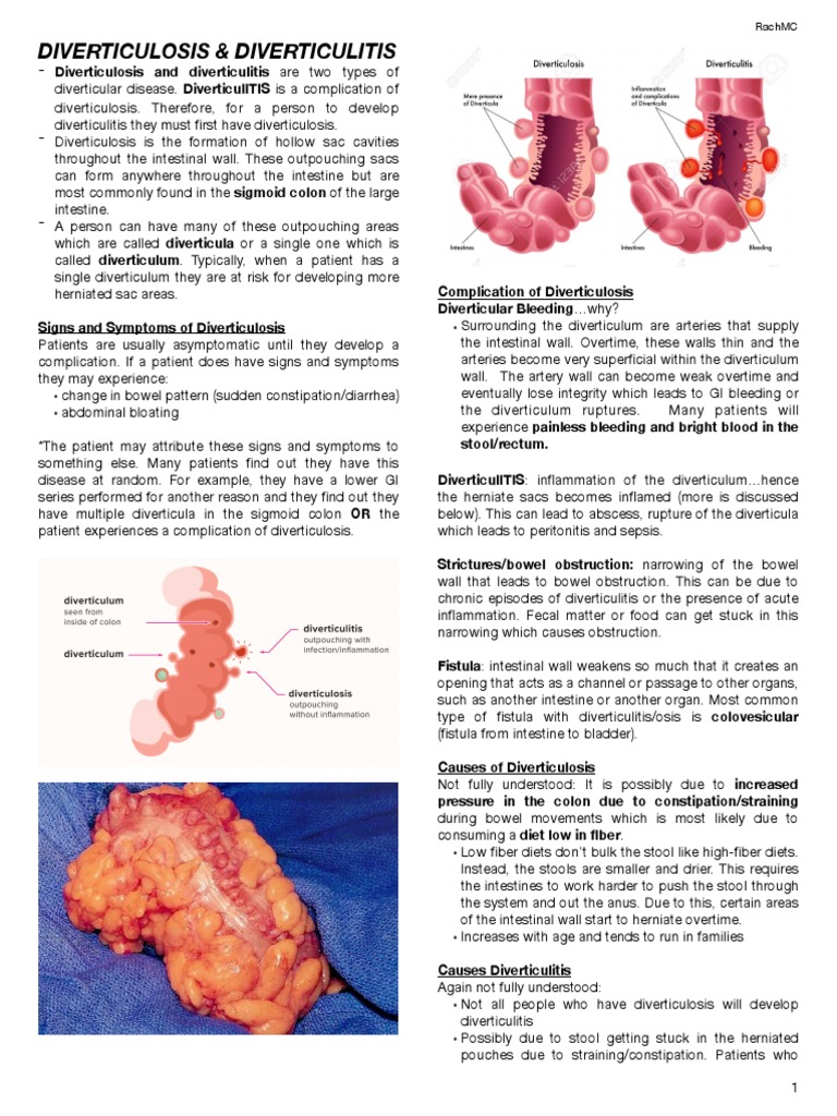MS Diverticulosis & Diverticulitis | PDF | Gastroenterology | Medical Specialties