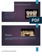 Diseño y Función de Pónticos en Prostodoncia | PDF | Diente