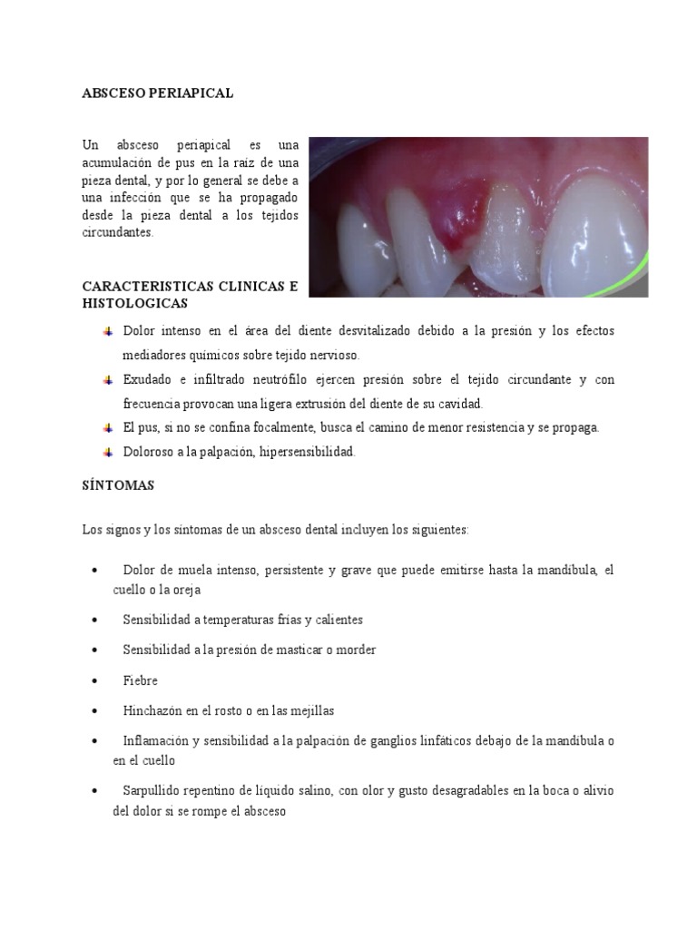 Absceso Periapical | PDF | Diente | Inflamación