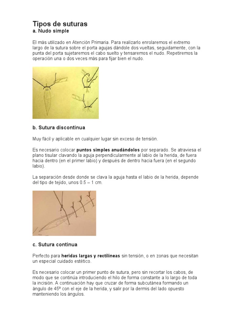 Tipos de Suturas | PDF | Inyección (medicina) | Sutura Quirúrgica