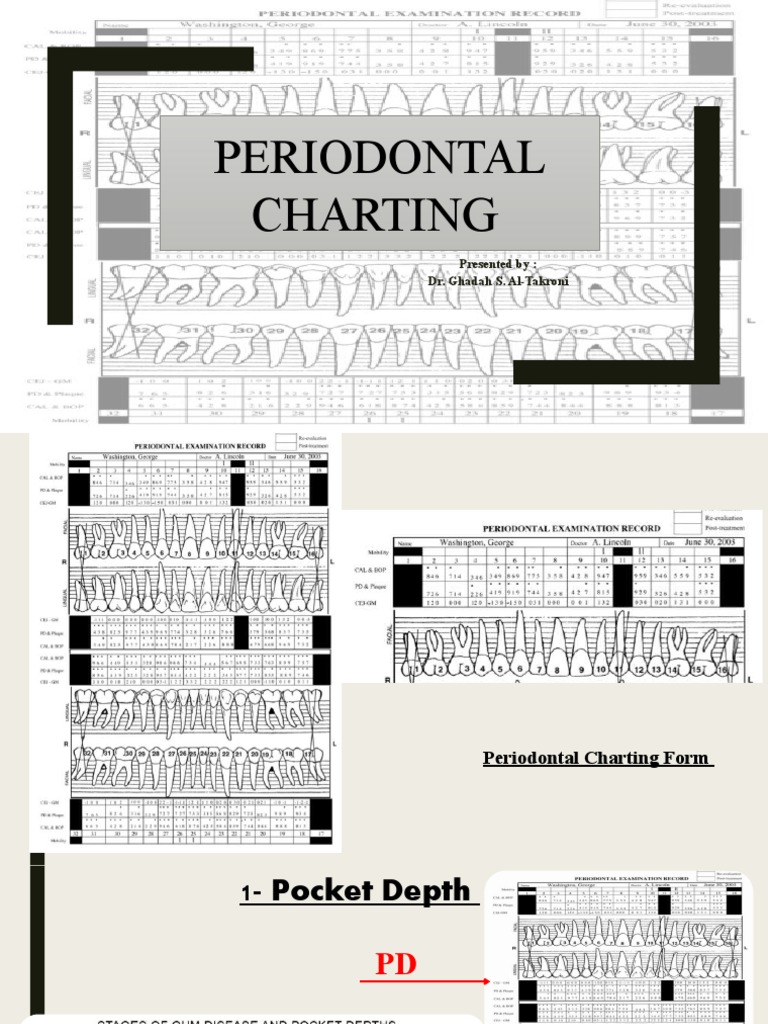 Periodontal Charting: Presented By: Dr. Ghadah S. Al-Takroni | PDF