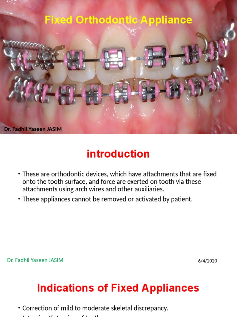 Overview of Fixed Orthodontic Appliances | PDF | Orthodontics | Face