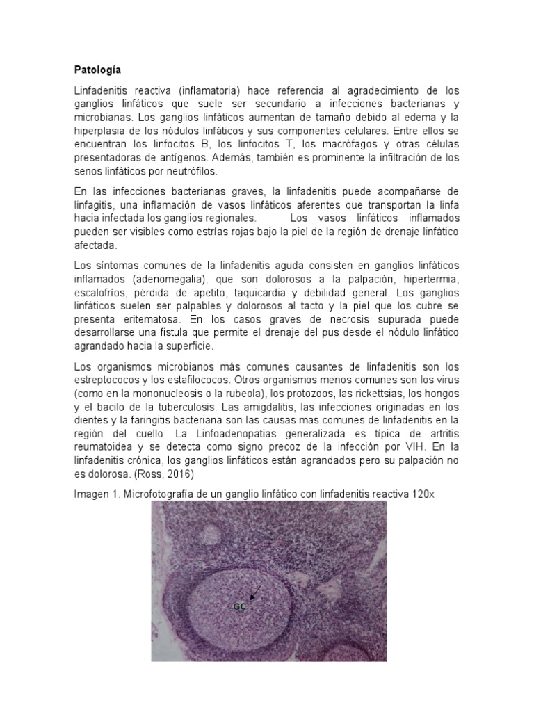 Linfadenitis Reactiva: Causas y Síntomas | PDF | Ganglio linfático ...