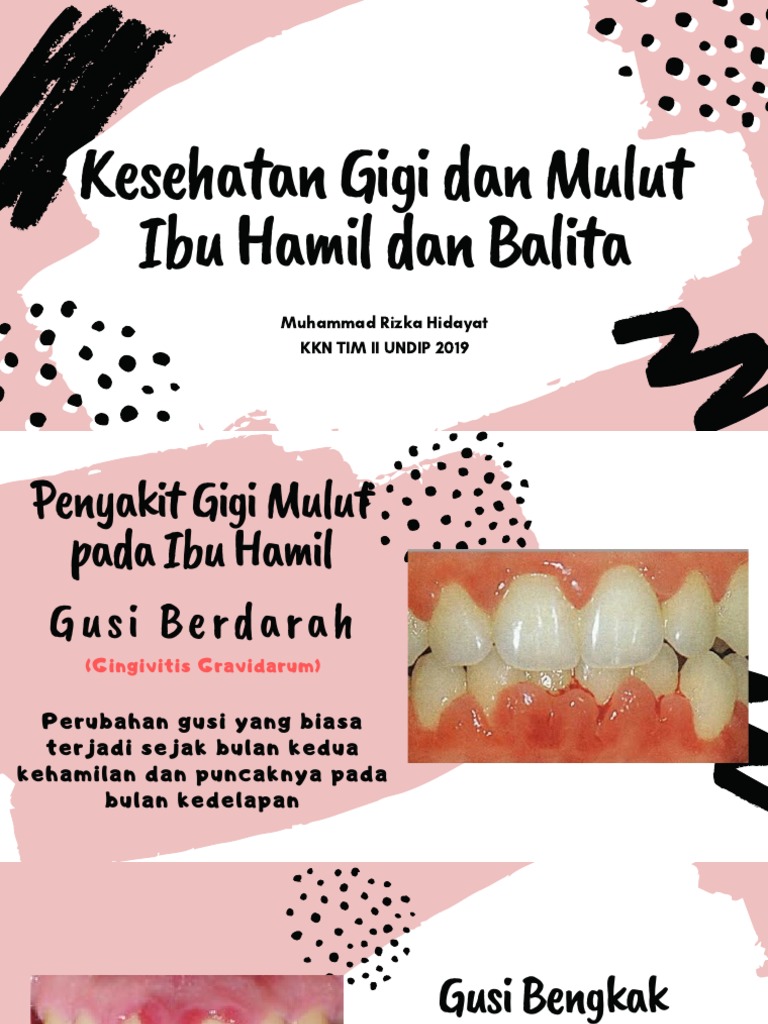 Kesehatan Gigi Dan Mulut Ibu Hamil Dan Balita | PDF