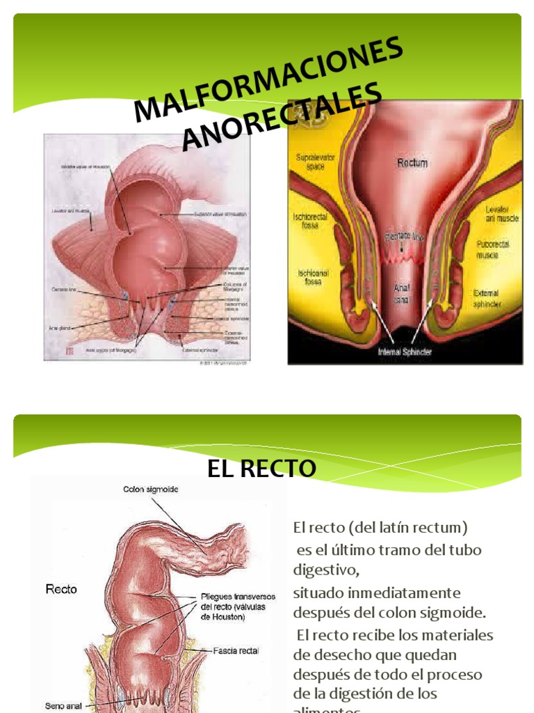 Malformaciones Anorrectales Exposicion 2 | PDF | Recto | Gastroenterología