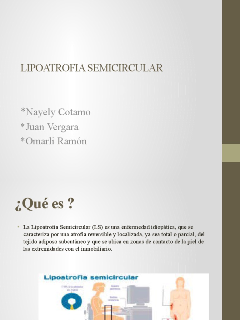 Lipoatrofia Semicircular | PDF | Ciencia y matemáticas