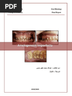 Palato-Labial Tooth Movement Z Spring: Uses | PDF | Dentistry ...