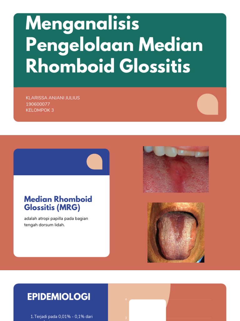 Median Rhomboid Glossitis | PDF
