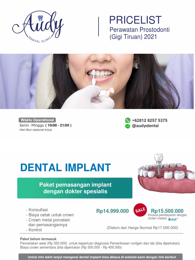 Pricelist Gigi Tiruan Audy Dental 2021 | PDF