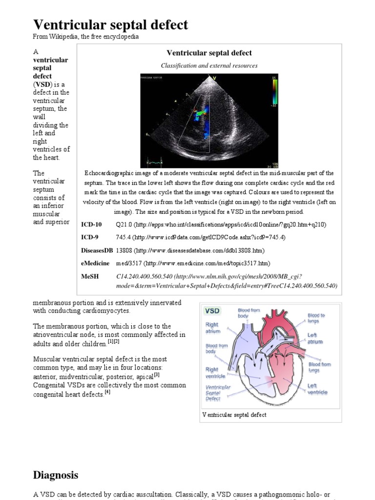 Overview of Ventricular Septal Defect | PDF | Cardiovascular Diseases ...
