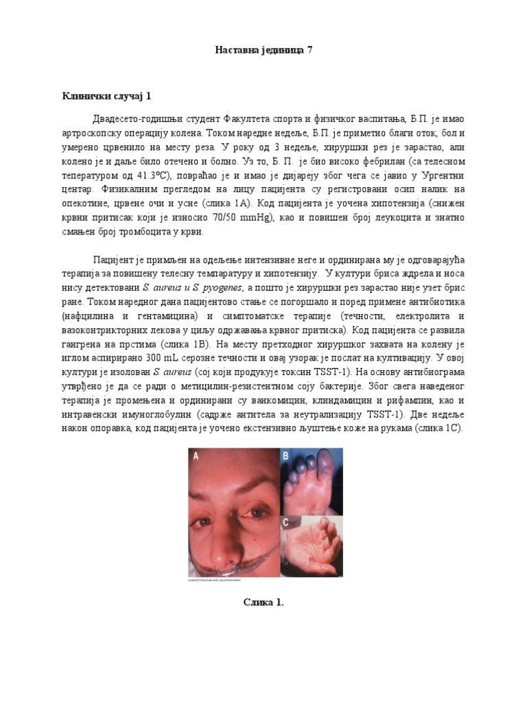 Klinicki Slucajevi | PDF