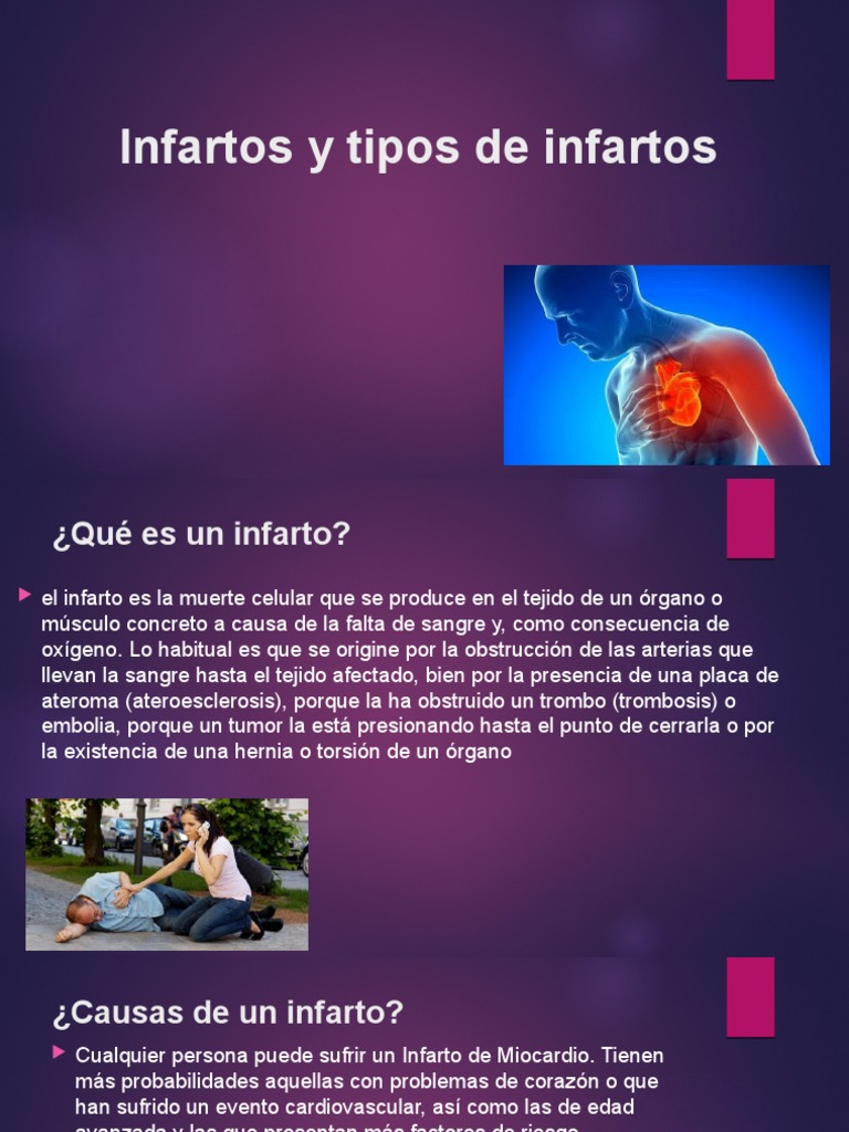 Infartos y Tipos de Infartos | PDF | Infarto de miocardio | Isquemia