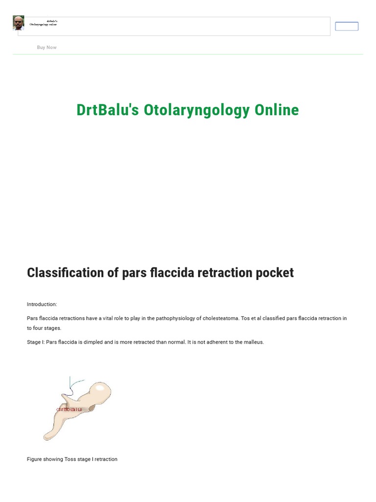 Pars Flaccida Retraction Classification | PDF