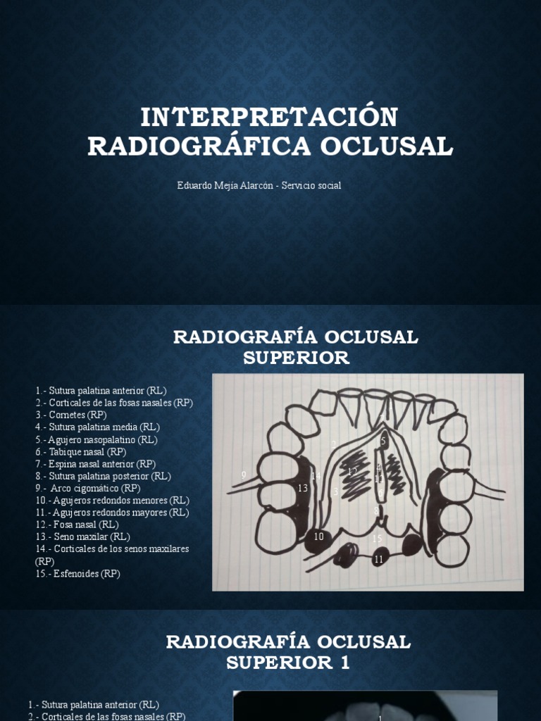 Interpretación Radiográfica Oclusal | Descargar gratis PDF | Rasgos faciales | Cara