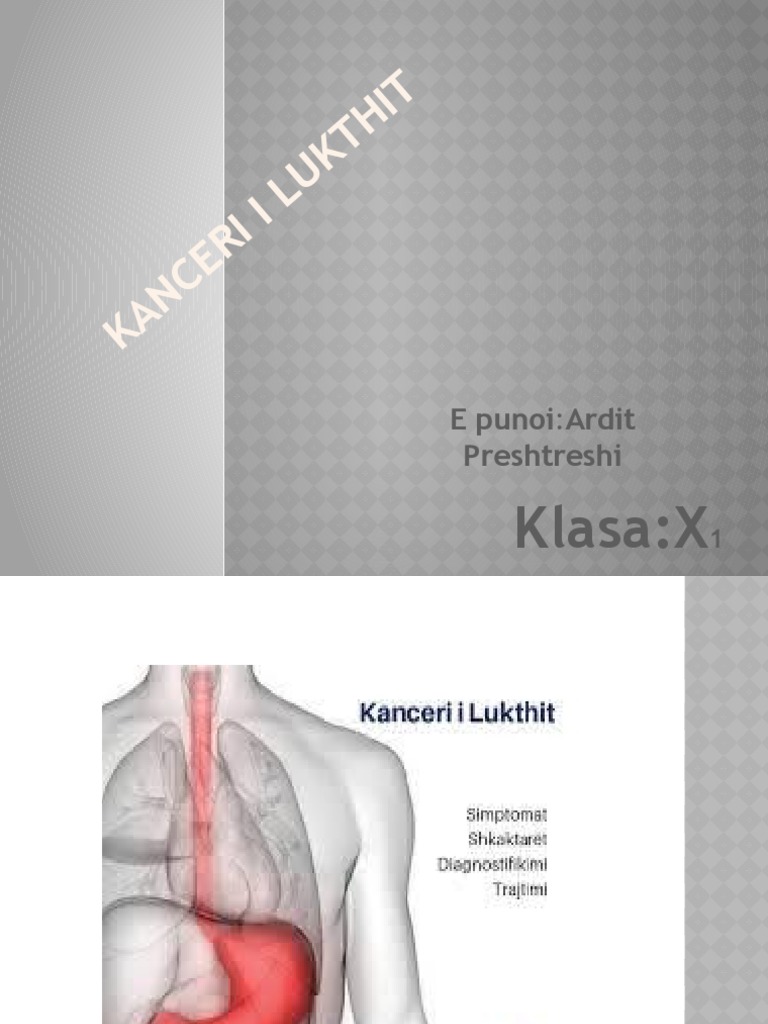 Kanceri I Lukthit | PDF