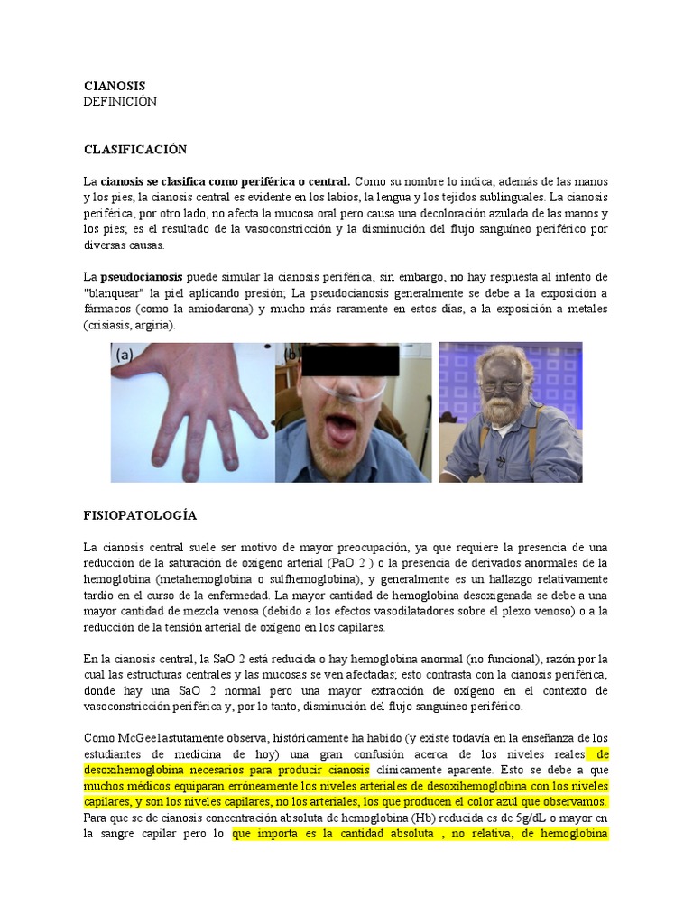 Tipos y causas de cianosis | PDF | Fisiología | Especialidades Medicas