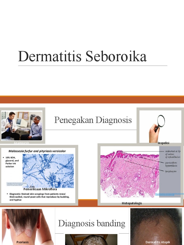 Dermatitis Seboroik | PDF