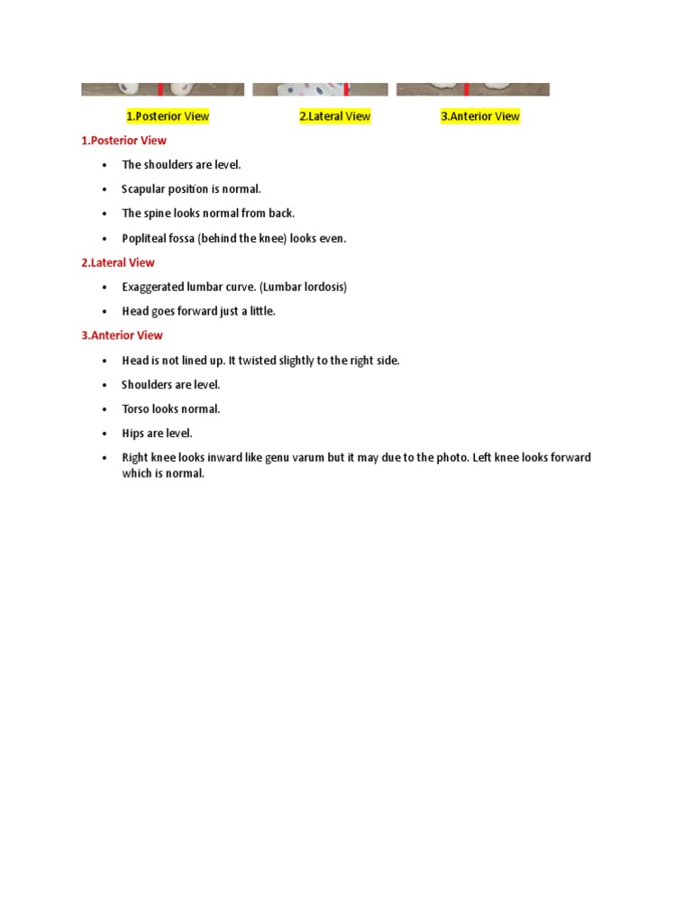 Posture Assessment | PDF
