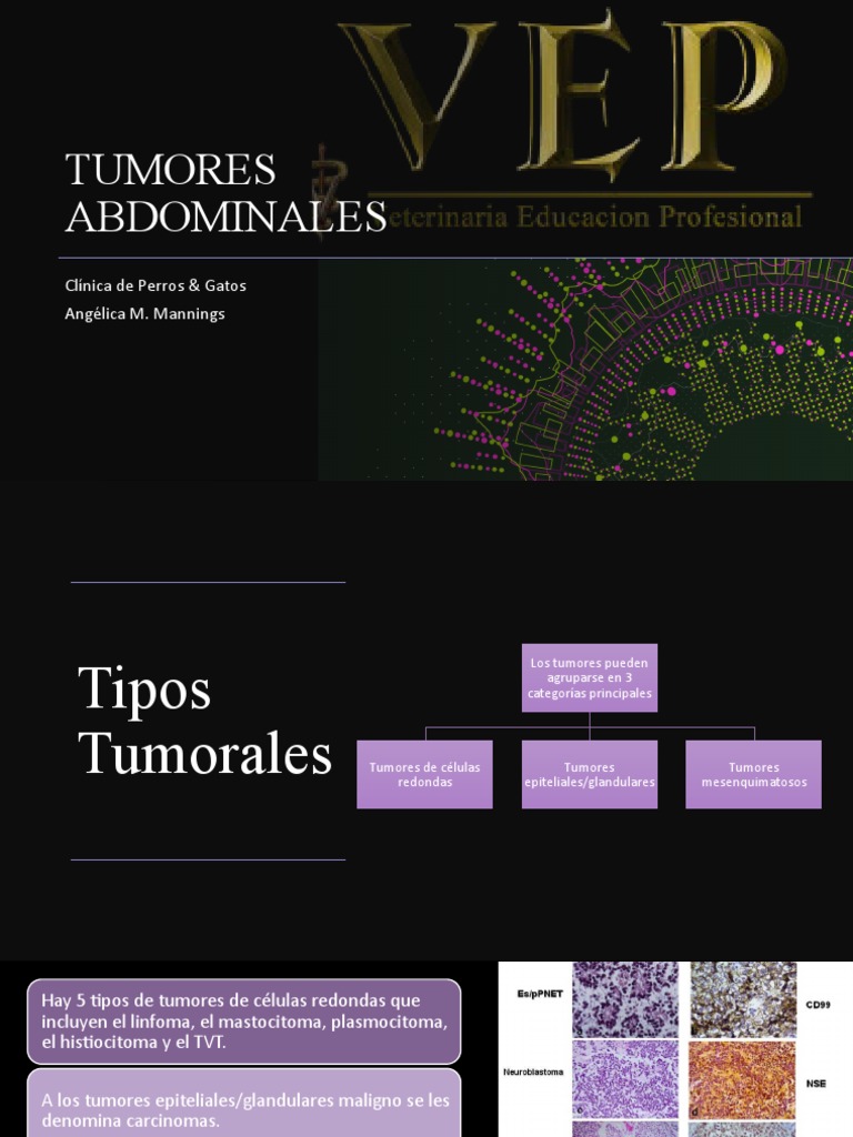 Tumores Abdominales | PDF | Adenocarcinoma | Neoplasias