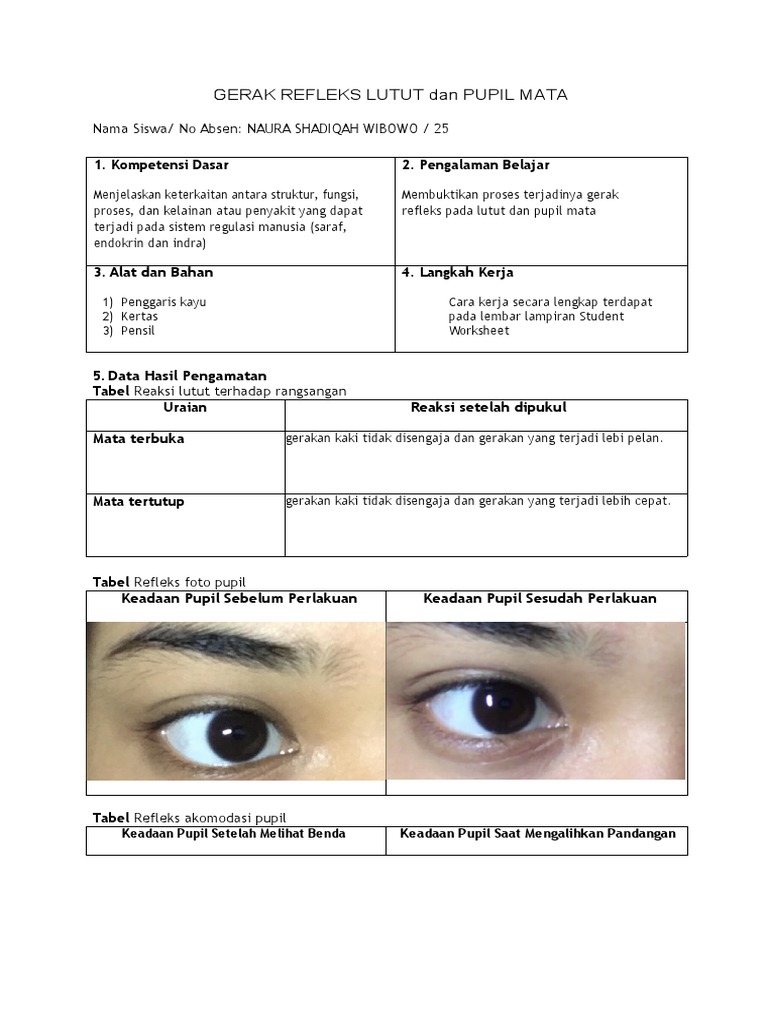Proses Gerak Refleks Lutut dan Pupil | PDF
