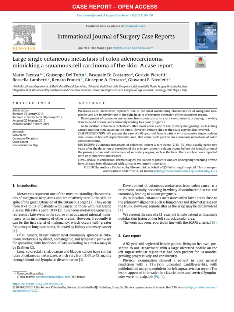 International Journal of Surgery Case Reports | PDF | Metastasis | Biopsy