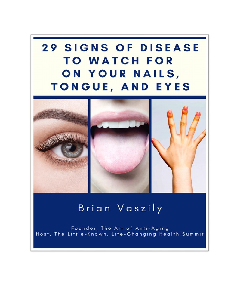 Signs of Disease - Nails and Tongue | PDF | Nail (Anatomy ...