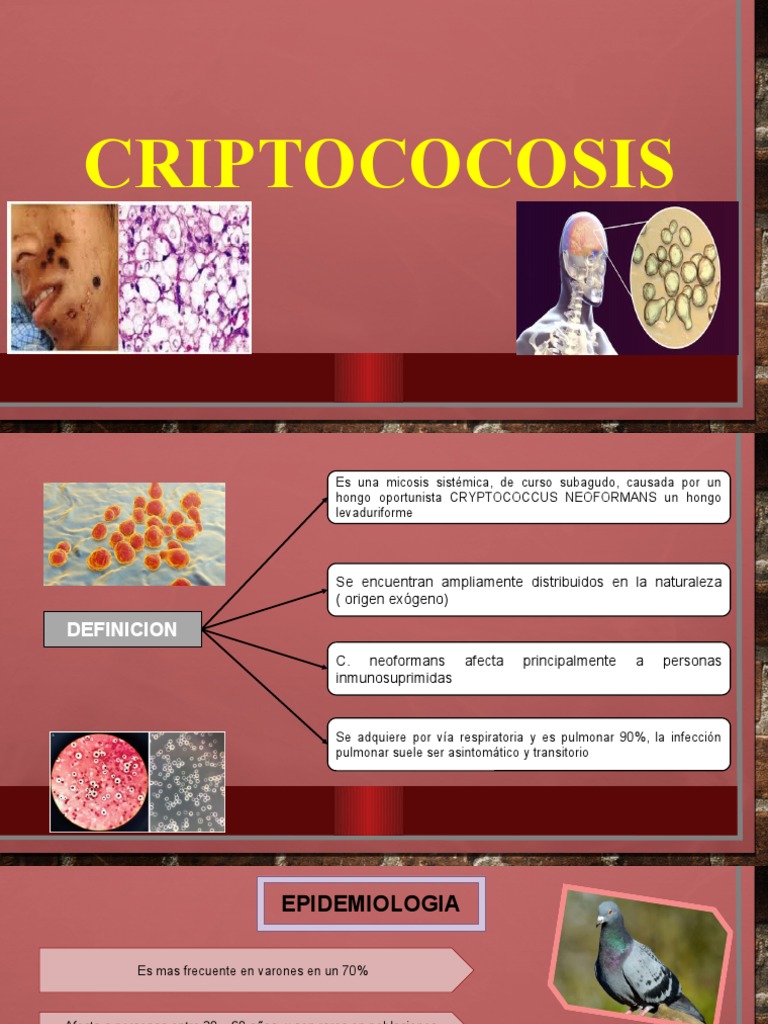 Criptococosis | PDF | Meningitis | VIH / SIDA