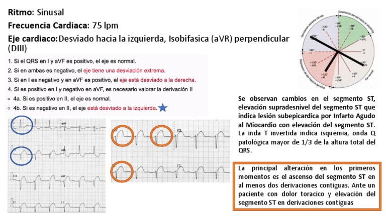 Ekg Icb | PDF