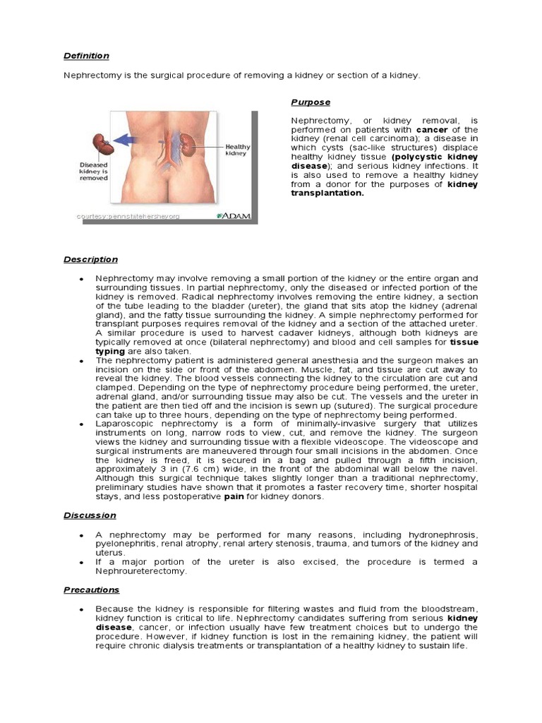 Nephrectomy | PDF | Kidney | Surgical Specialties