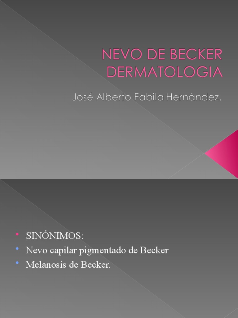 Nevo de Becker | PDF