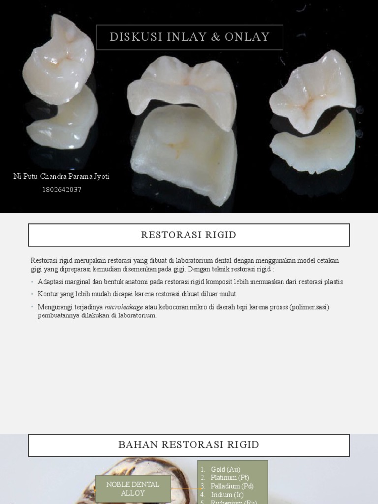 INLAY RESTORASI | PDF