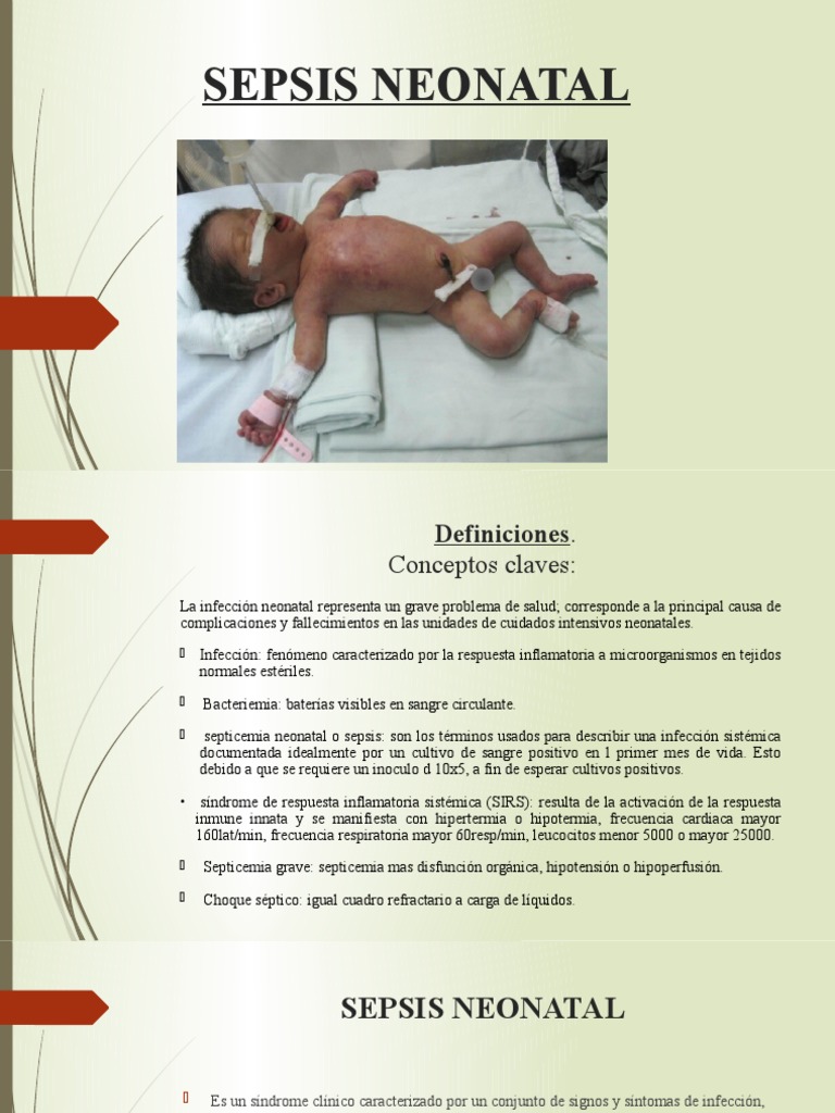 5 - Sepsis Neonatal | PDF | Septicemia | Cuidado de la salud