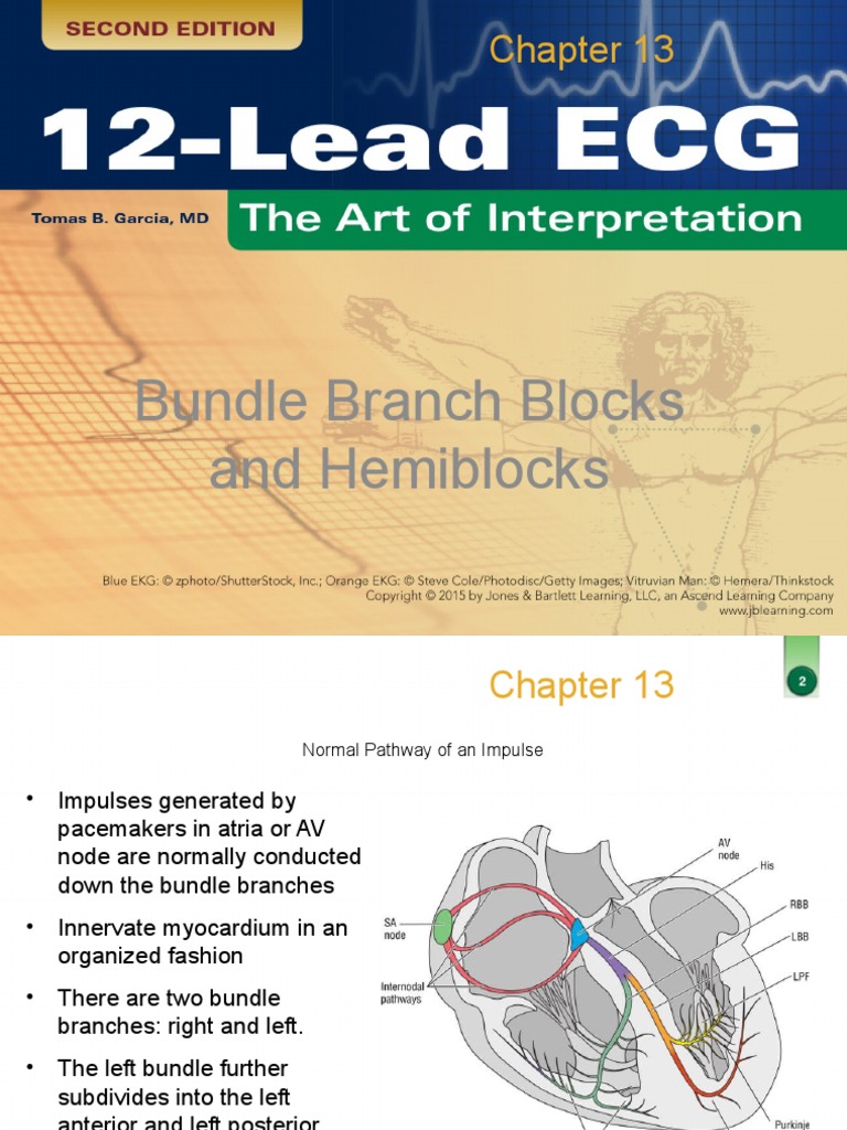 Bundle Branch Blocks and Hemiblocks | PDF | Electrocardiography ...