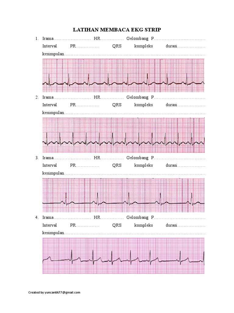 Latihan Membaca Ekg Strip | PDF