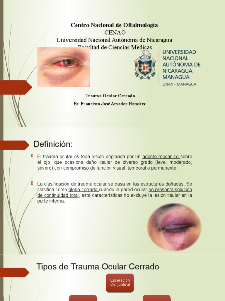 Trauma Ocular Cerrado FJAR | PDF | Lesión | Emergencias Médicas