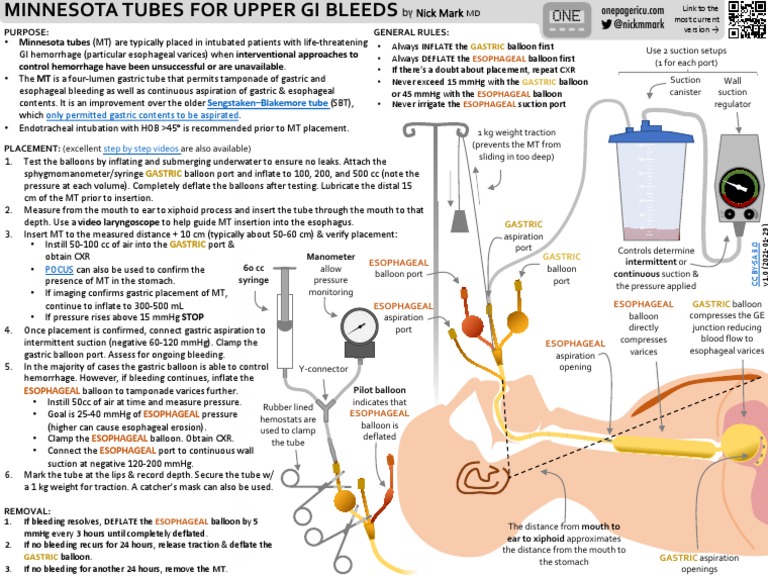 ICU One Pager Minnesota Tube | PDF | Esophagus | Medical Specialties